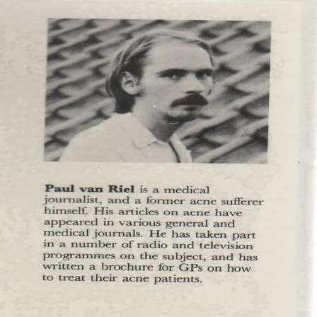 Health, Mind & Body - ACNE, HOW IT'S CAUSED AND HOW TO CURE IT - PAUL ...