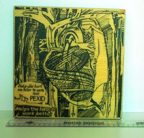 Other Antiques & Collectables - NILS BURWITZ RESIN ETCHING OF THE HUMAN ...