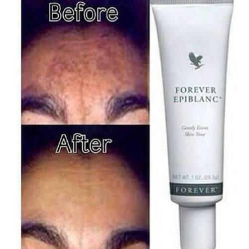 Face - BLEMISHES GONE! FOREVER LIVING PRODUCTS! was listed for R99.00 ...